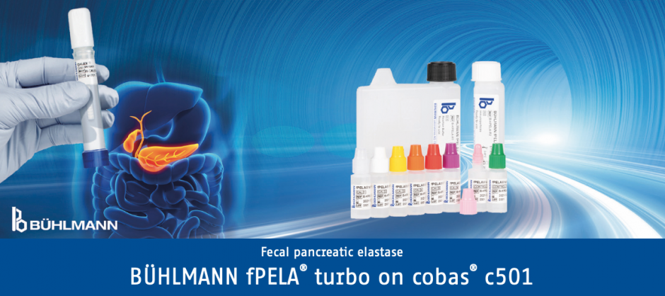 BUHLMANN fCAL® turbo (calprotectin) - Fecal Calprotectin ...